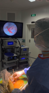 Chirurgie du Rachis en Endoscopie : Une approche mini-invasive